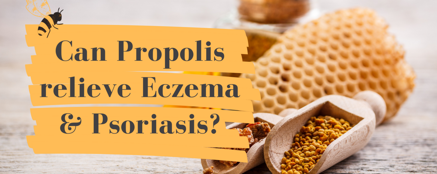 Why Propolis May Be the Answer to Relieving Your Psoriasis and Eczema ...